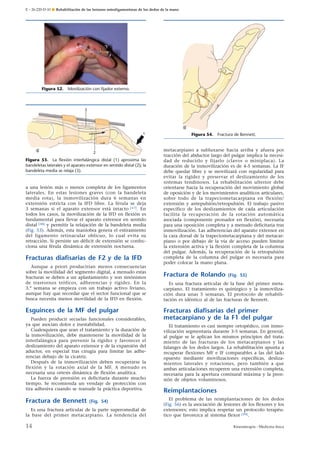 Rehabilitación de las lesiones osteoligamentosas de los dedos de la ...