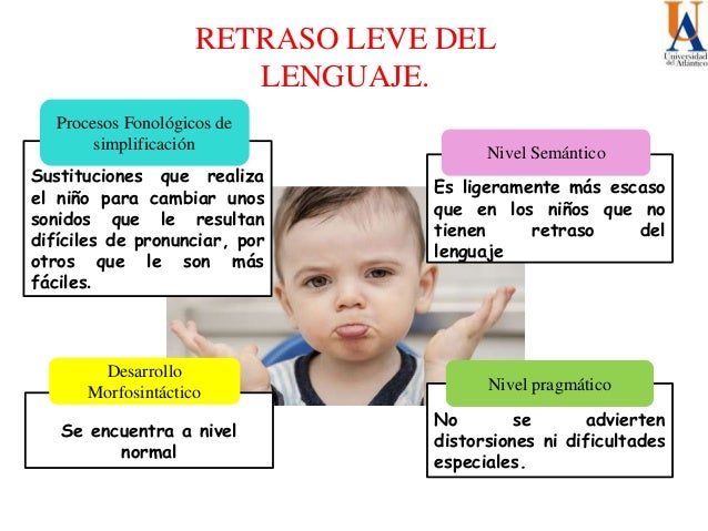 Retraso del lenguaje