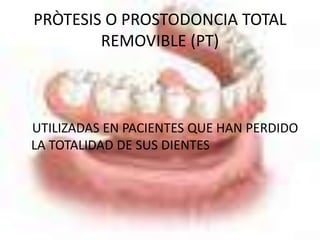 Rehabilitacion oral prostodoncia | PPTX