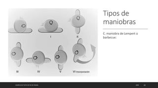 Rehabilitacion vestibular maniobras.pptx