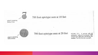 Rehabilitation of Peripheral Field Defects | PPTX