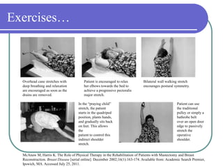 Rehabilitation-After-Breast-Cancer-Surgery.ppt