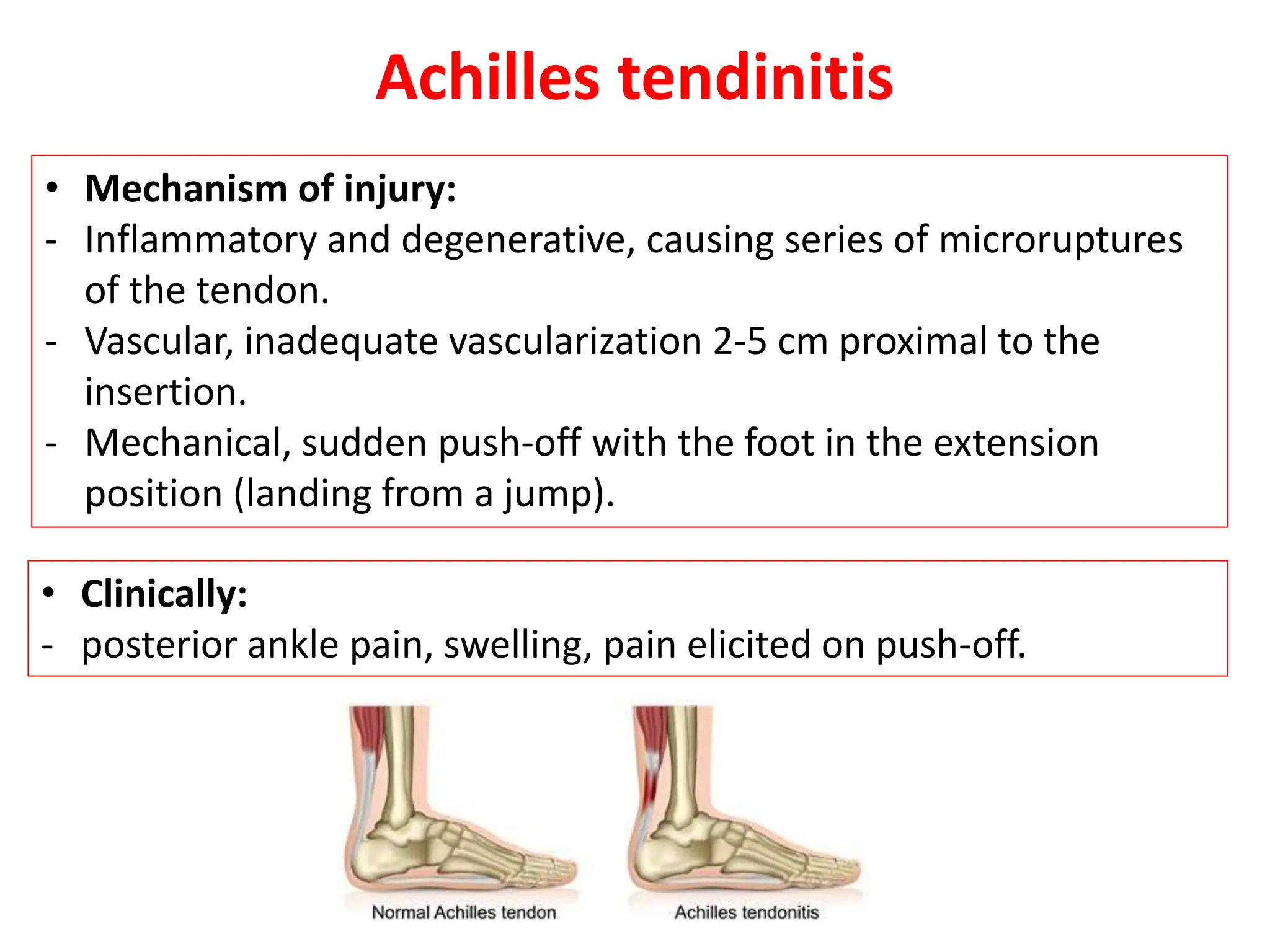 Rehabilitation-of-Tendinitis.pptx medicine | PPTX