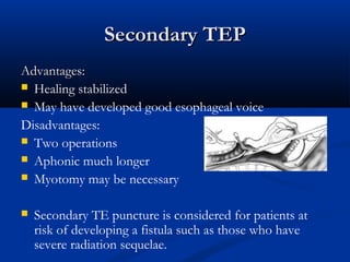 Rehabilitation after treatment of cancer larynx sujay susikar | PPT