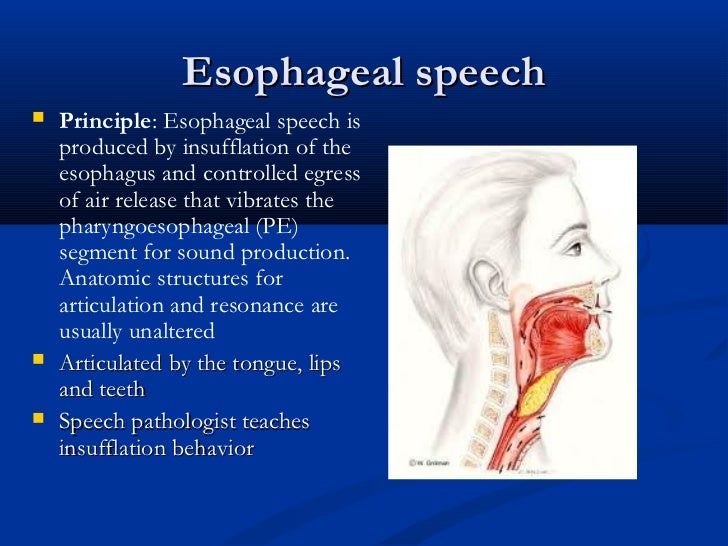 Rehabilitation after treatment of cancer larynx sujay susikar