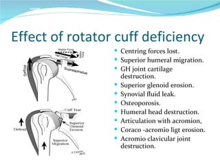 Rehabilitation following a reversed total shoulder arthroplasty nwulg ...