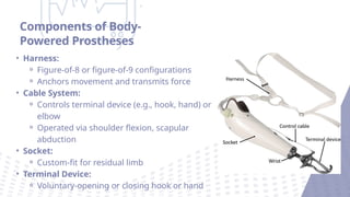 Rehabilitation of Adults with Upper-Limb Amputations by Dr.Rumaisa PT ...