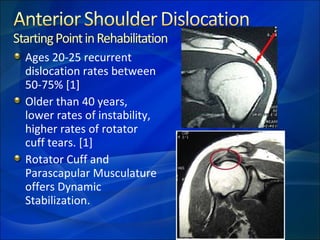 Rehabilitation Of Anterior Shoulder Dislocation | PPT