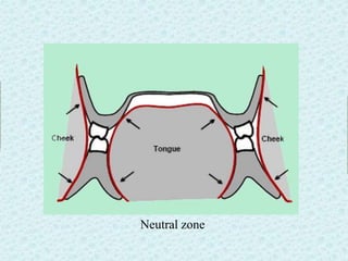 Rehabilitation of a patient with severely resorbed mandibularfinal | PPT