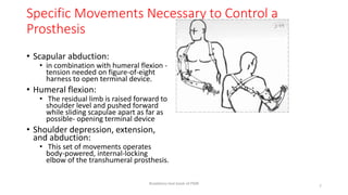 Rehabilitation of dominant upper limb amputation | PPTX
