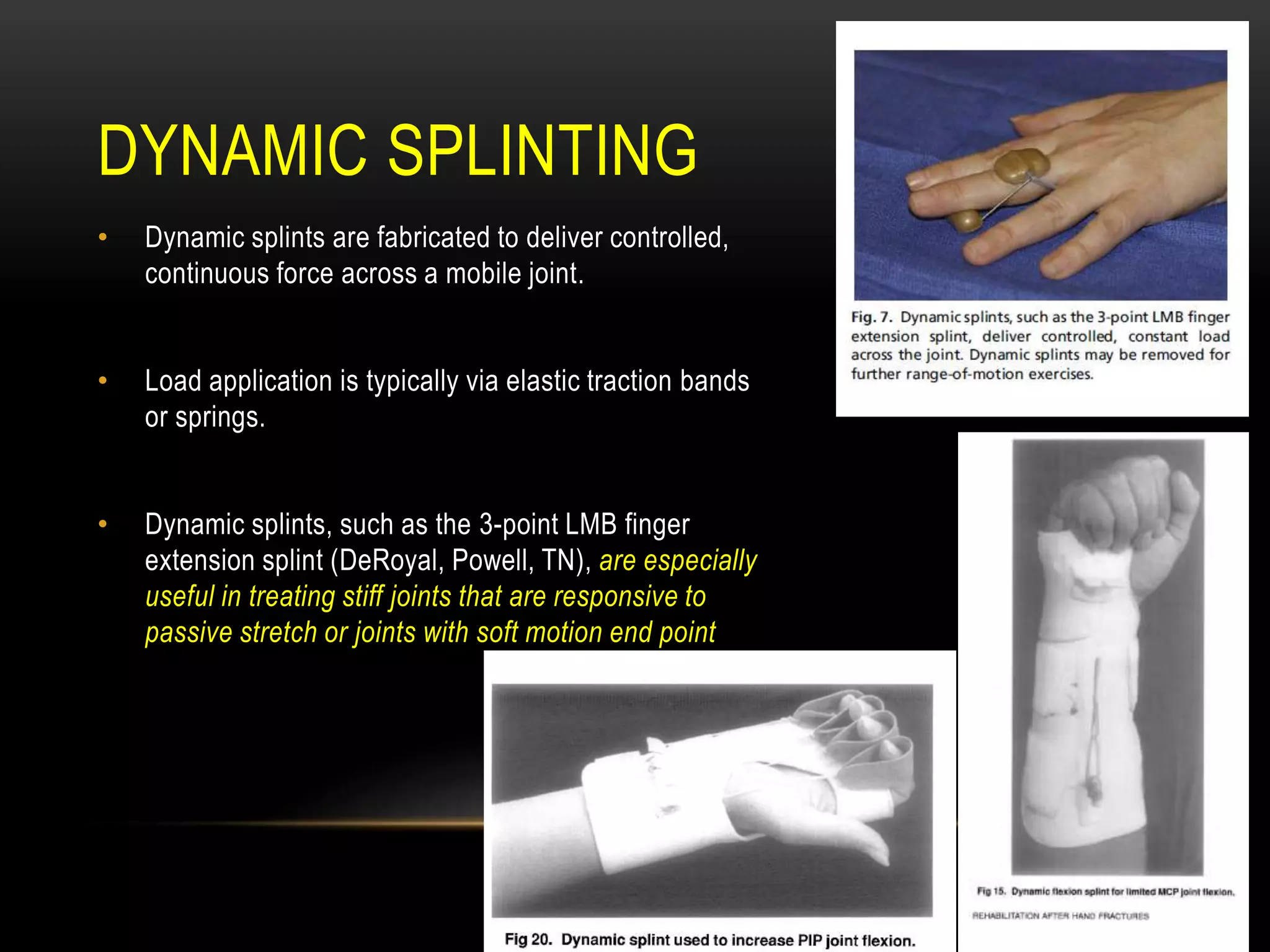 Rehabilitation of hand fractures | PPTX