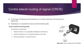 Rehabilitation of hearing impaired.pptx