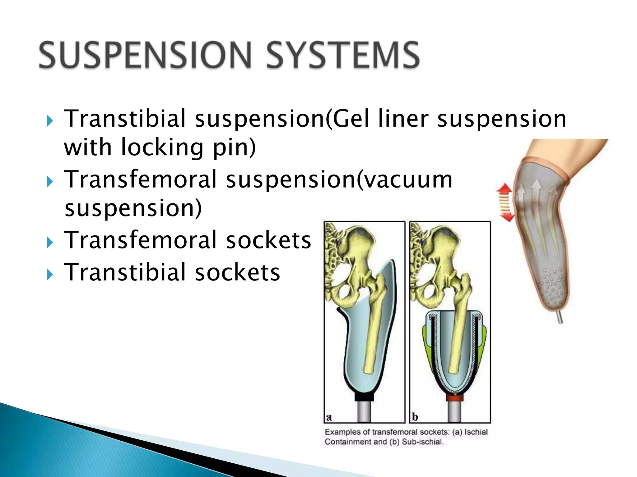 Rehabilitation of lower limb amputee | PPTX