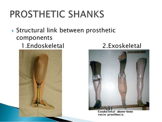 Rehabilitation of lower limb amputee