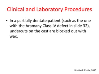Rehabilitation of Patients with Maxillary Surgical Defects | PPTX