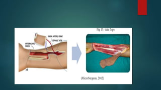 Rehabilitation Post Burn Injury.pdf
