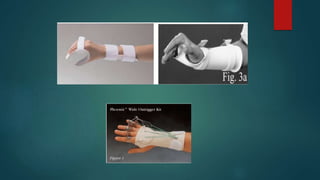 Rehabilitation Post Burn Injury.pdf