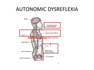 Rehabilitation 國考題 sci complications | PPT
