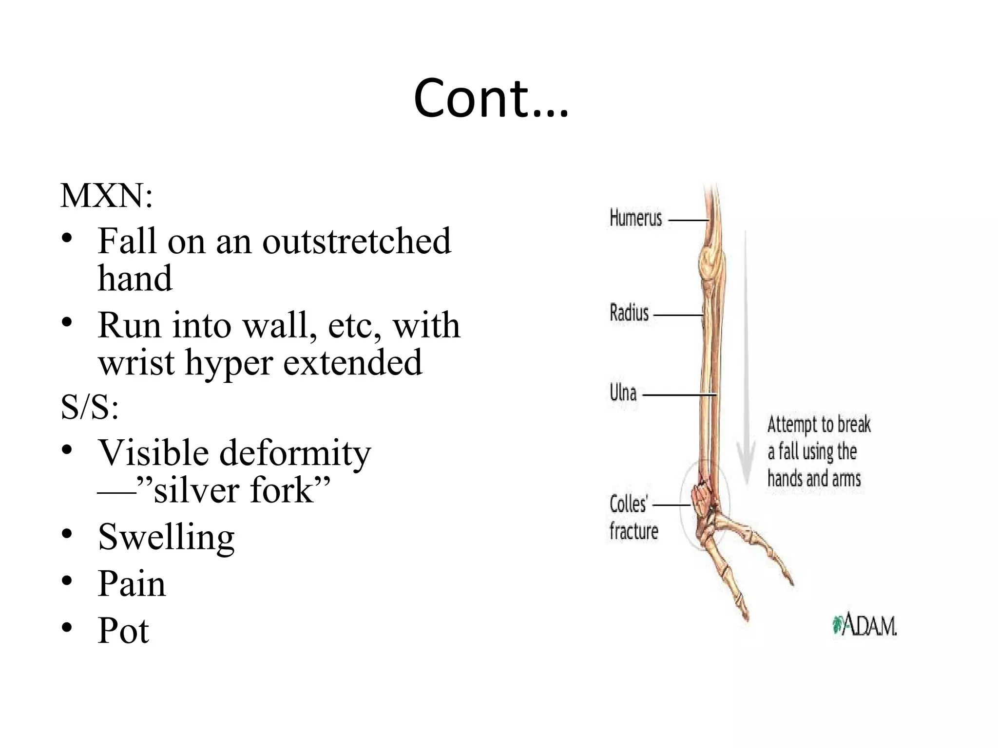 Rehab of injuries to the wrist and hand power pt | PPT