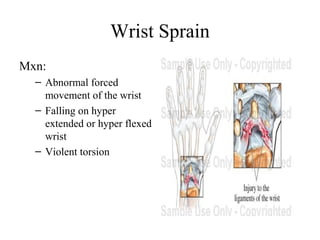 Rehab of injuries to the wrist and hand power pt | PPT