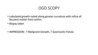 REHUMAN tumorboard final.pptx