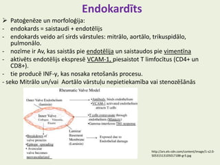 Reimatiskais drudzis | PPT