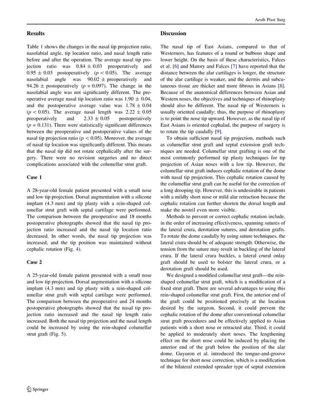 A Novel Technique of Asian Tip Plasty by Dr. Man Koon, Suh from JW Plastic Surgery | PDF