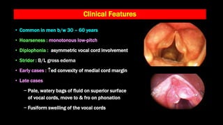 Reinke's edema .pptx