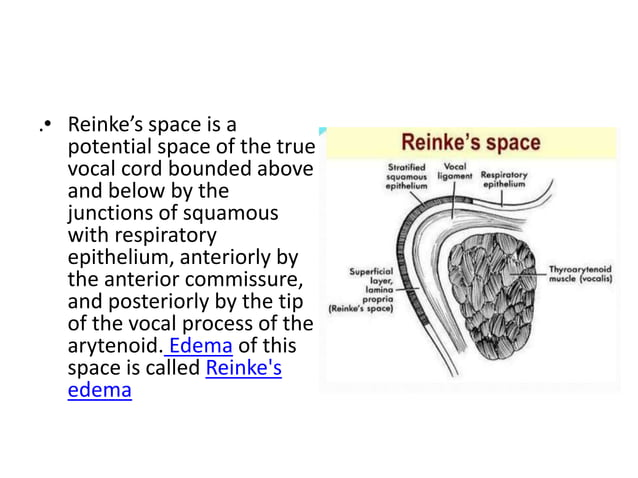Reinke's oedema | PPTX
