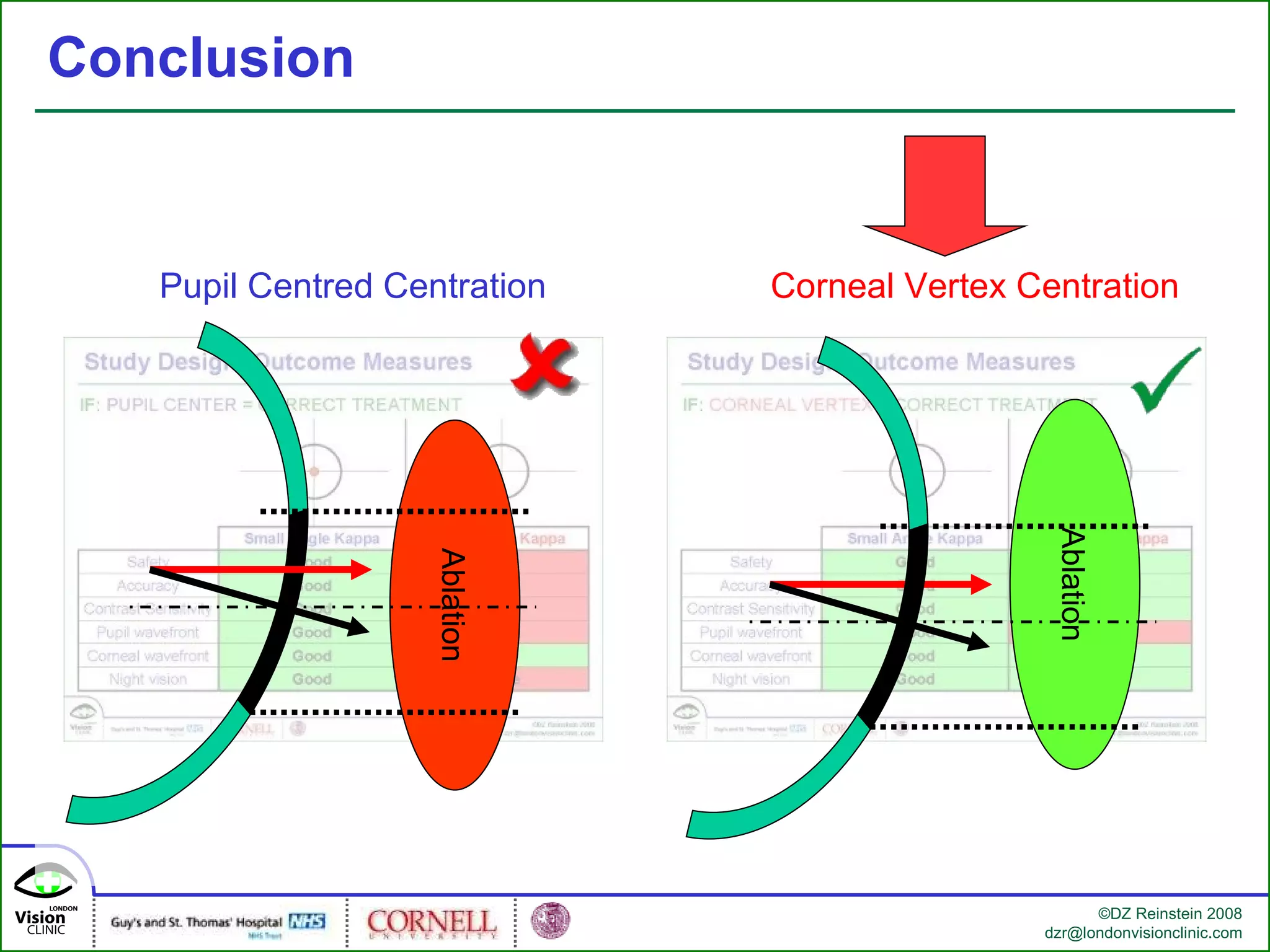 Centration of Hyperopic Corneal Ablations: Corneal Vertex vs. Pupil ...