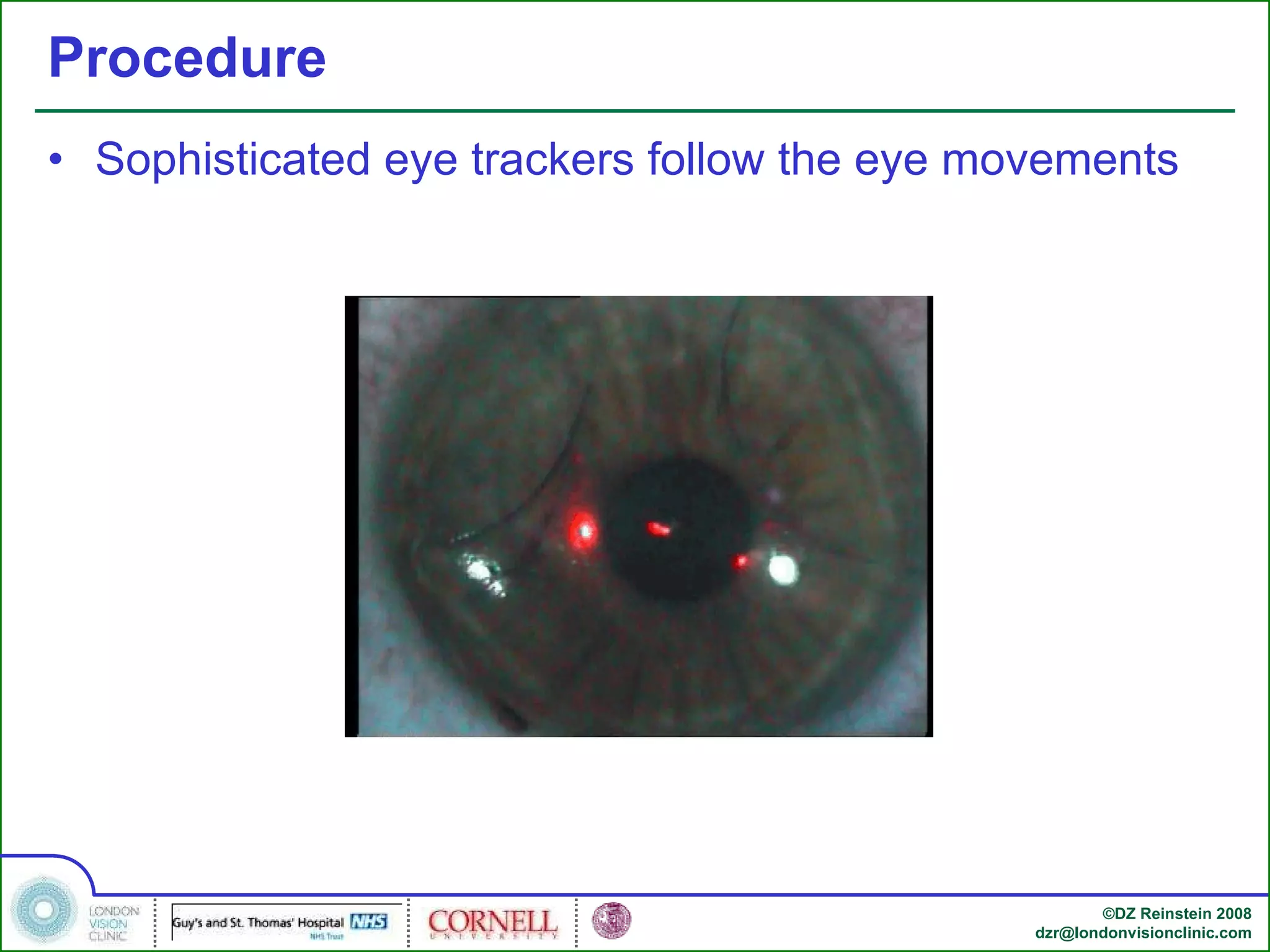 Introduction to Refractive Eye Surgery | PPT