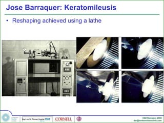 Introduction to Refractive Eye Surgery | PPT