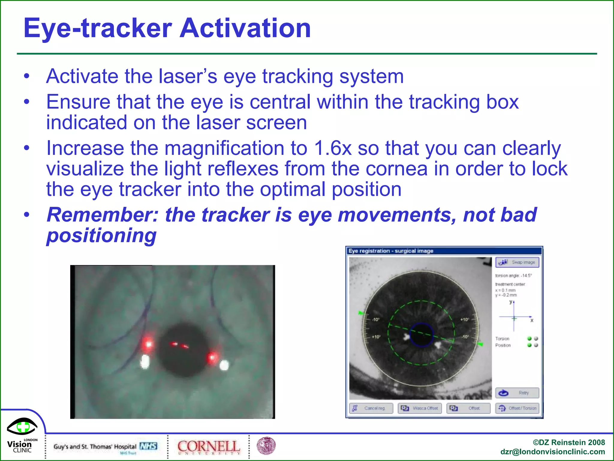 The Routine LASIK Procedure | PPT