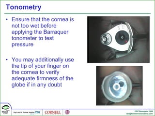 The Routine LASIK Procedure | PPT
