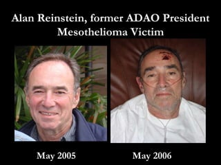 Linda Reinstein: Miles for Meso: “Asbestos: Still Lethal and Legal in ...