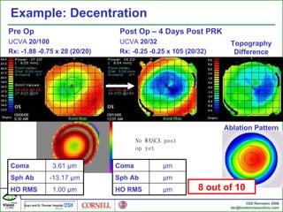 6 Month Results of Topography Guided Repair | PPT