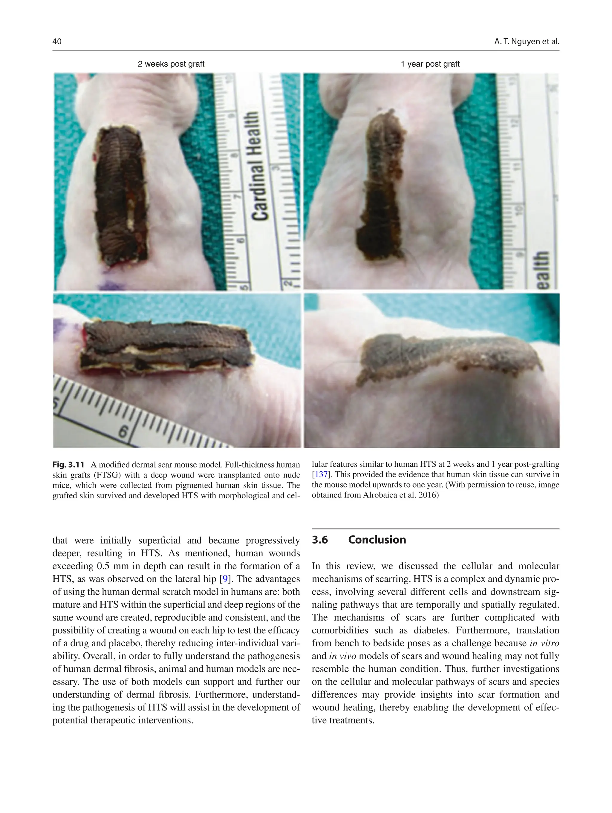 Rei Ogawa - Total Scar Management_ From Lasers to Surgery for Scars, Keloids, and Scar ...