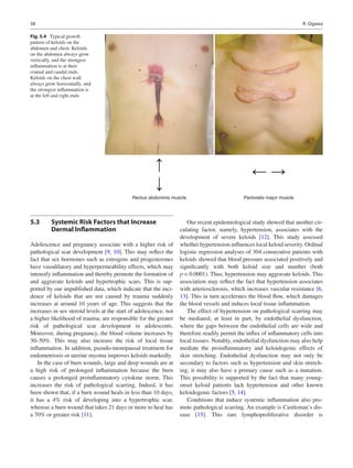Rei Ogawa - Total Scar Management_ From Lasers to Surgery for Scars ...