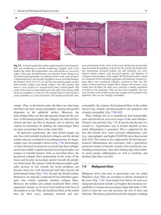 Rei Ogawa - Total Scar Management_ From Lasers to Surgery for Scars ...