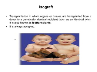 Organ Transplantation and rejection | PPTX