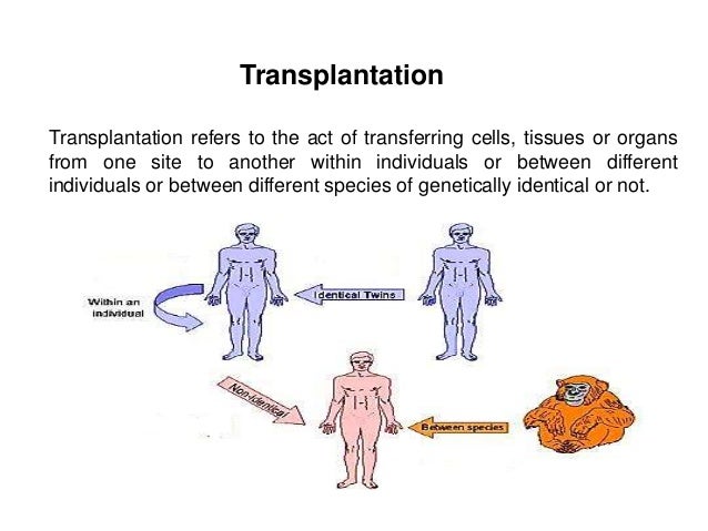 Organ Transplantation and rejection