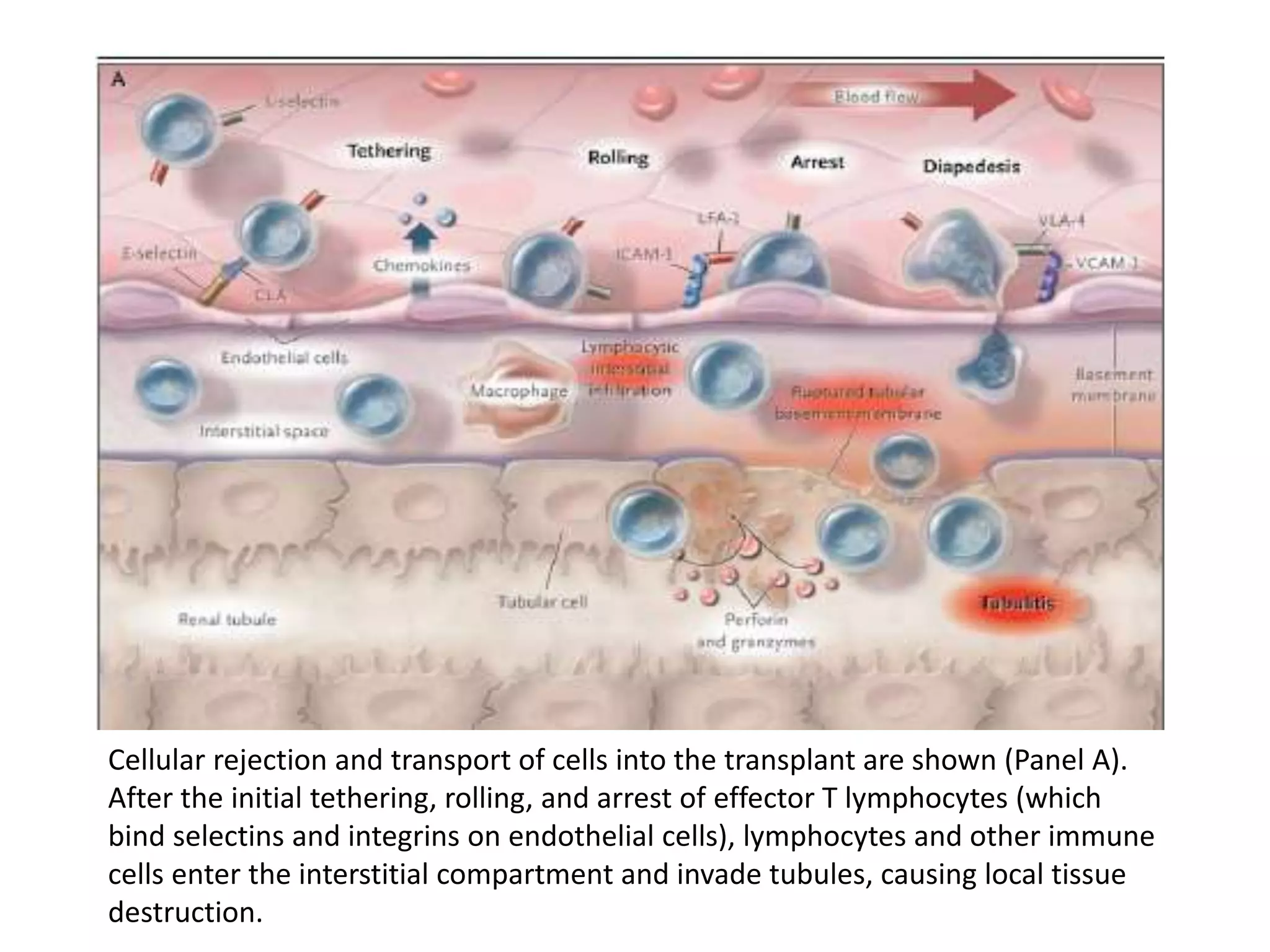 Rejection of the kidney allograft | PPTX