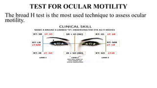 OCULAR MOTILITY, OCULAR MOVEMENT OF THE EYE .pptx