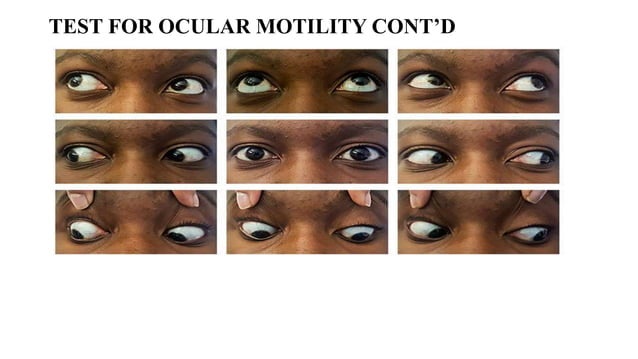 OCULAR MOTILITY, OCULAR MOVEMENT OF THE EYE .pptx