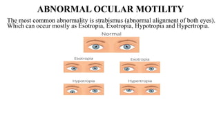 OCULAR MOTILITY, OCULAR MOVEMENT OF THE EYE .pptx