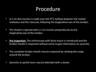 Rejul journal club- tendoscopy | PPT