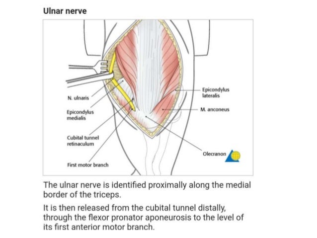 Distal Humerus Fracture Management- Rejul