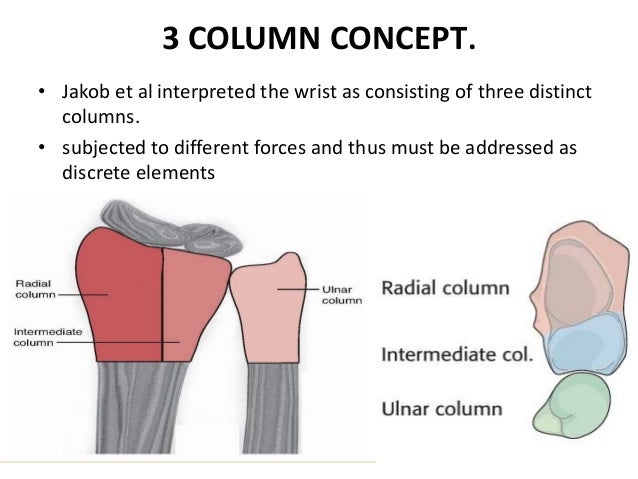 Distal Radius Fractures- Journal club