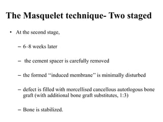 Masquelet's technique Journal club- REJUL | PPTX