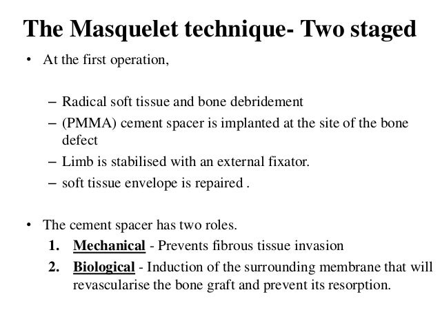 Masquelet's technique Journal club- REJUL